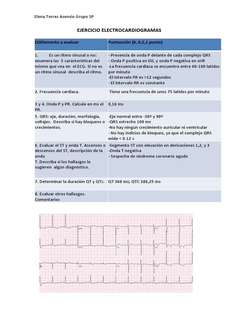EJERCICIO ELECTROCARDIOGRAMAS. Elena Torres | PDF | Electrocardiografia | Sistema cardiovascular
