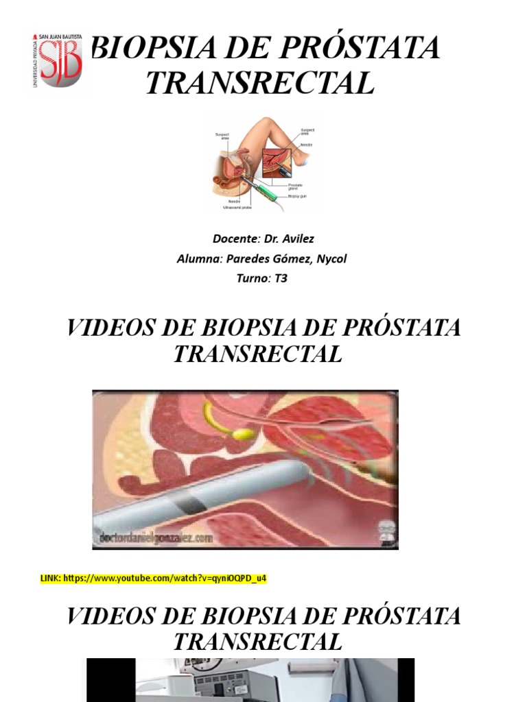 BIOPSIA DE PRÓSTATA TRANSRECTAL | PDF
