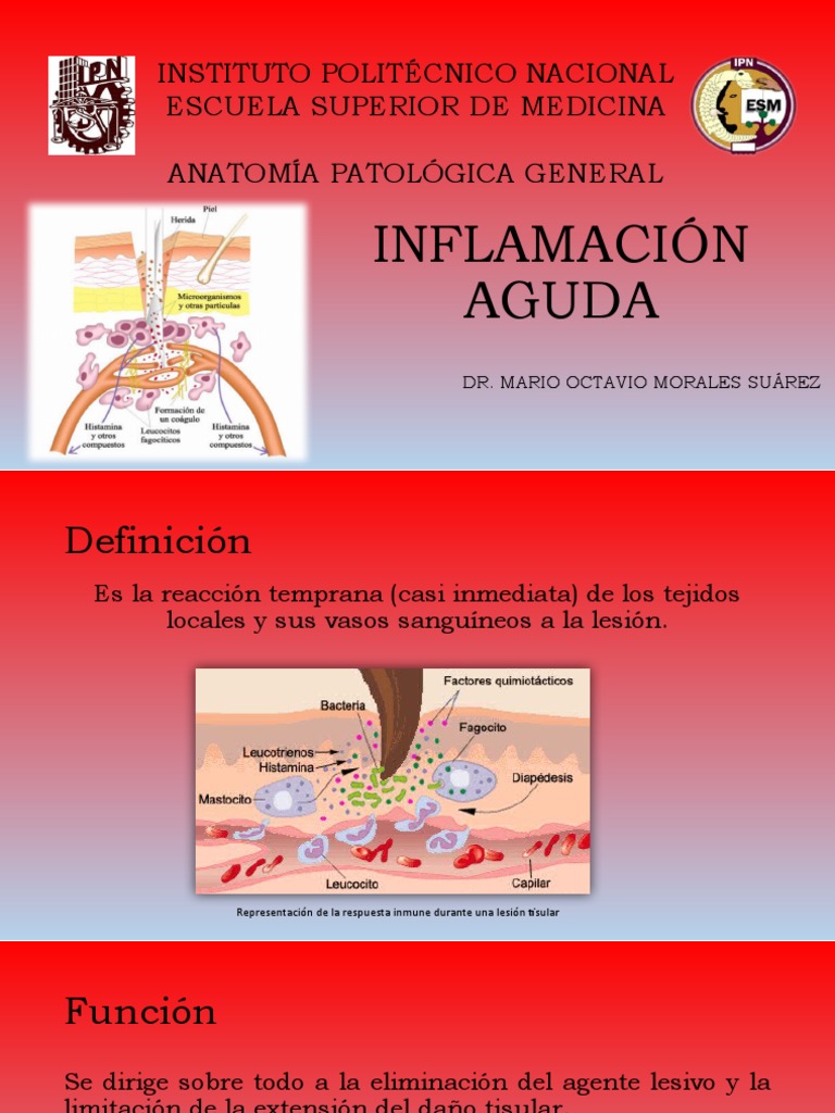 Procesos de la inflamación aguda: fases, mediadores y tipos de exudados | PDF | Inflamación ...