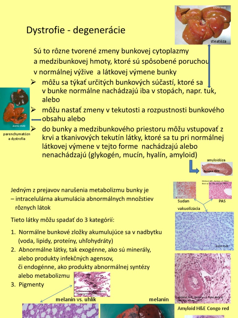 Dystrofie II. - Revajová PDF | PDF