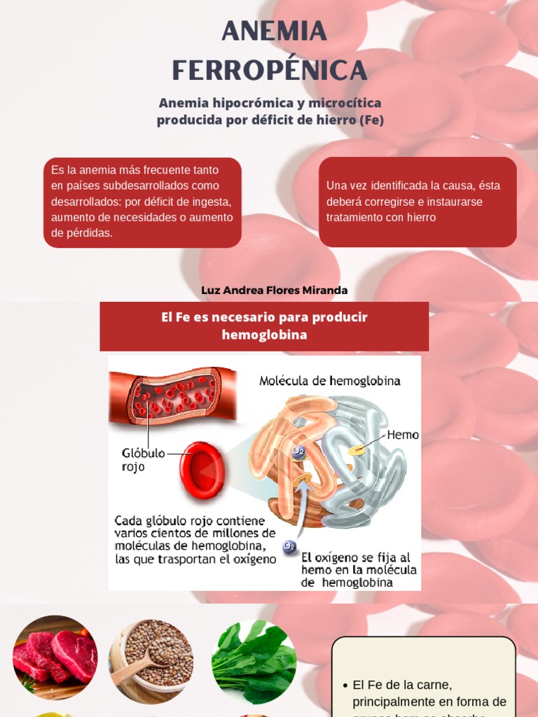 Anemia Ferropénica: Anemia Hipocrómica y Microcítica Producida Por ...