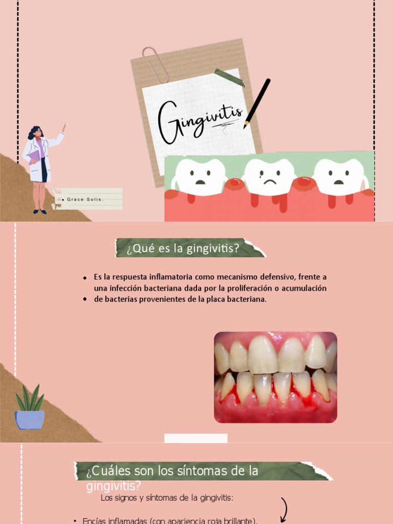gingivitis-199734-downloable-1378205 (1) (1).pptx | PDF | Higiene oral ...