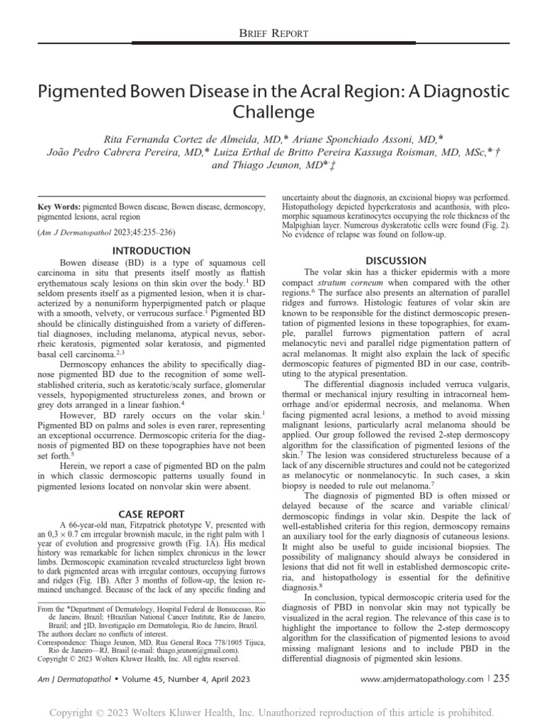 Pigmented Bowen Disease in The Acral Region A Diagnostic Challenge ...