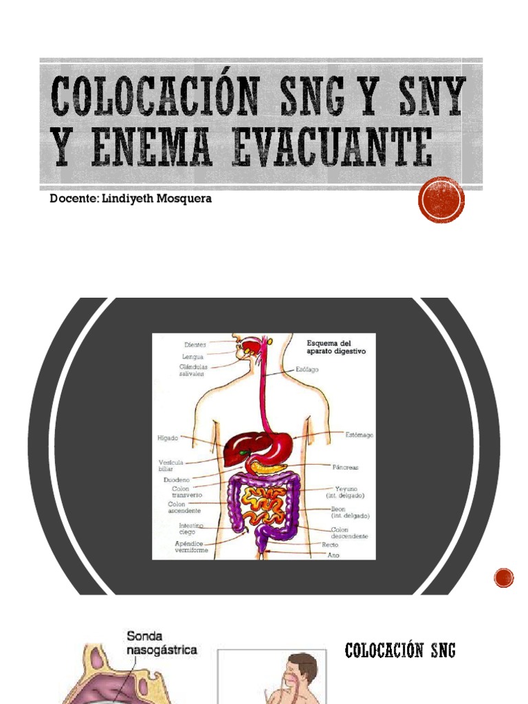 Clase de Colocación SNG Y SNY | PDF | Hemorroides | Heces