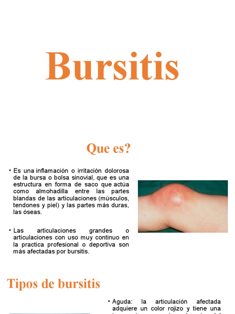 Bursitis | PDF | Rodilla | Epidemiología