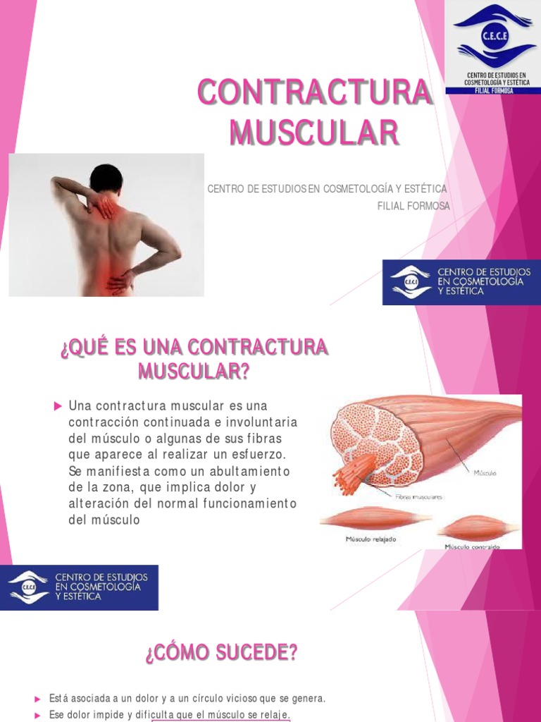 Clase 4 Contractura - Tipos PDF | PDF