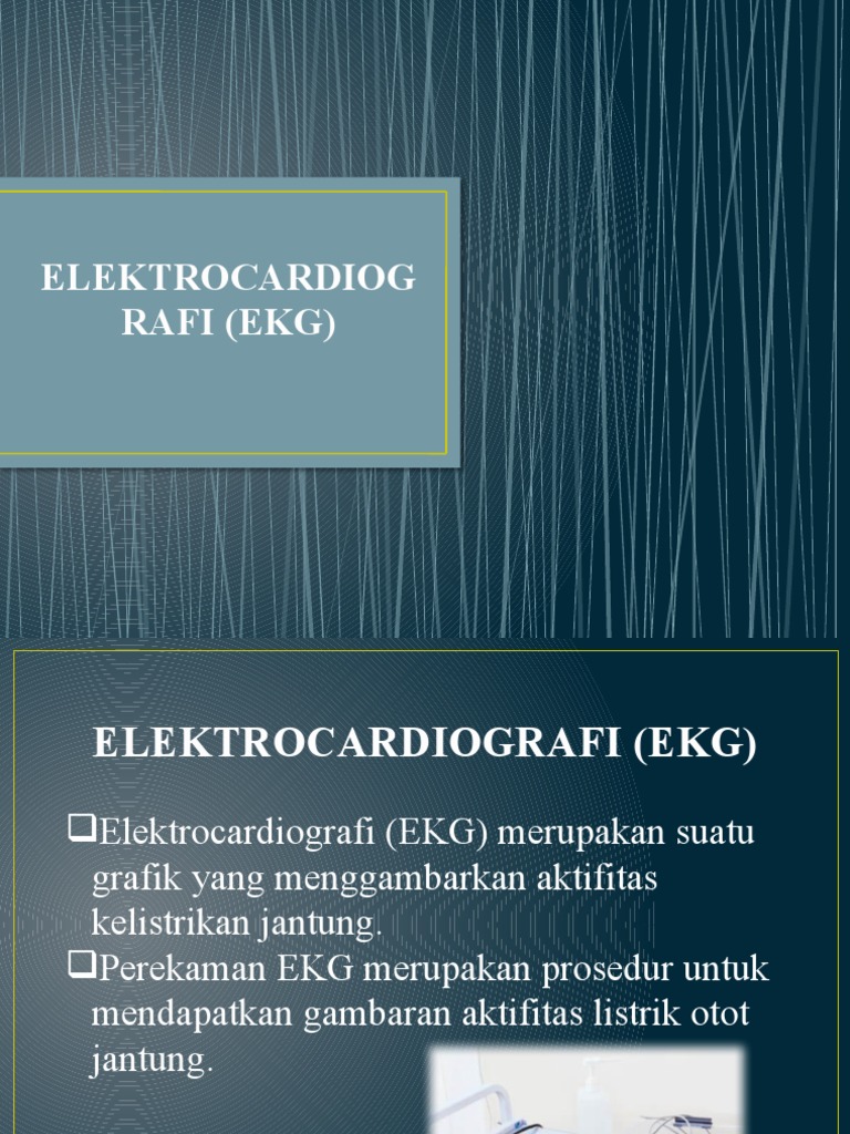 Elektrocardiografi (Ekg) | PDF