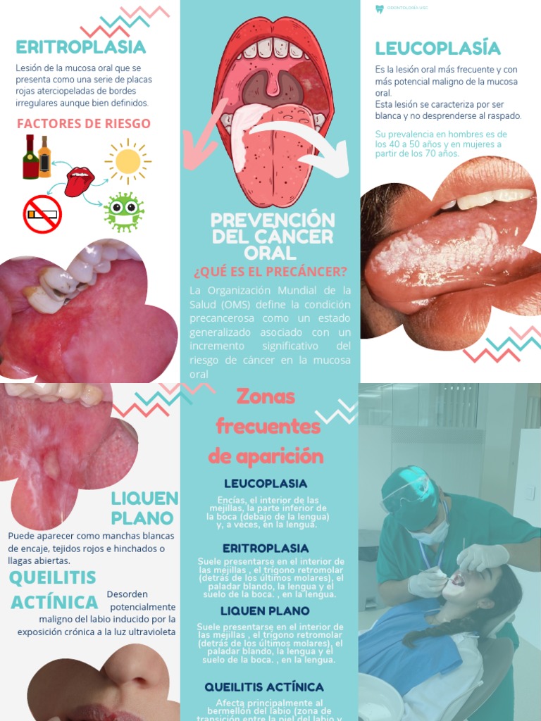 DÃ - Ptico Precancer Oral | PDF | Cáncer | Odontología