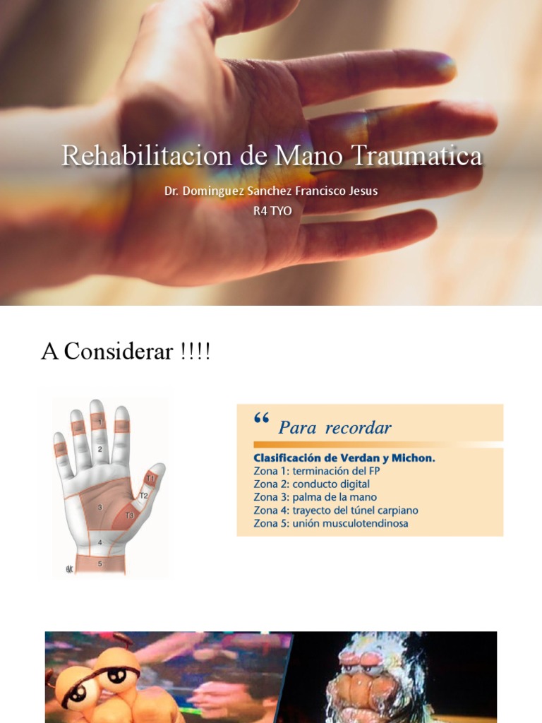 Rehabilitación de Mano Traumatica | PDF | Especialidades Medicas ...