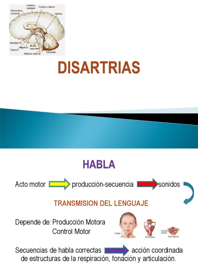 Tipos y causas de disartria | PDF | Cerebro | Sistema nervioso central