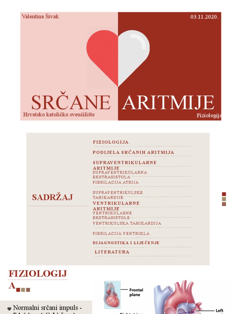 Srčane Aritmije | PDF
