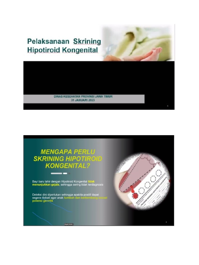 Pelaksanaan Skrining Hipotiroid Kongenital | PDF