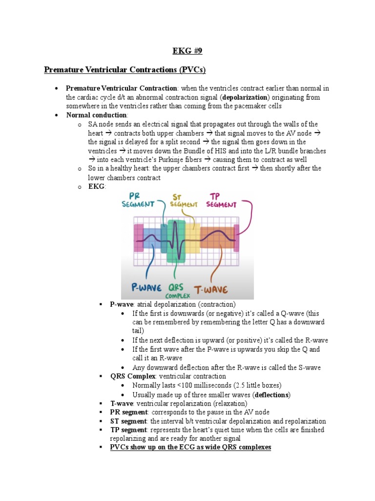 EKG - Premature Ventricular Contractions (PVCS) | PDF ...