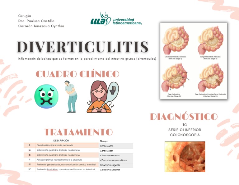Diagrama Diverticulitis | PDF