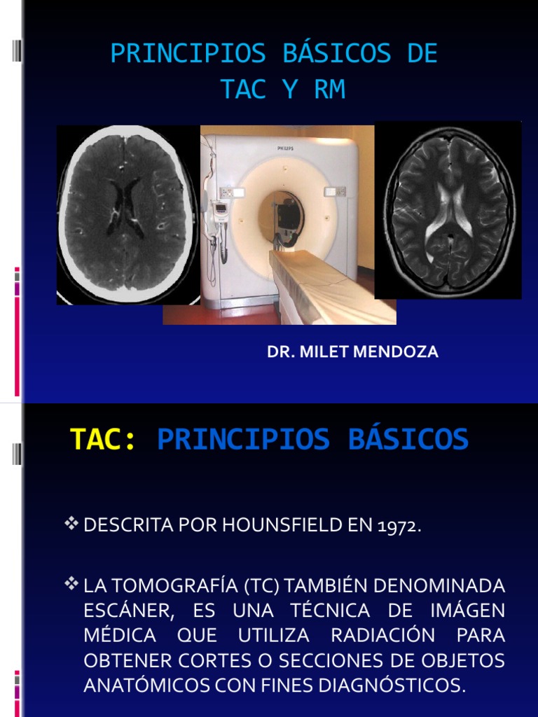 Principios básicos de TAC y RM: Una comparación de las ventajas y usos de la tomografía ...