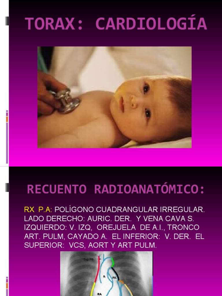 4-Radiología Cardíaca | PDF | Ventrículo (corazón) | Aorta