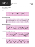 Guía para Trabajo Preliminar y Autoevaluación ACLS | PDF | Relaciones ...