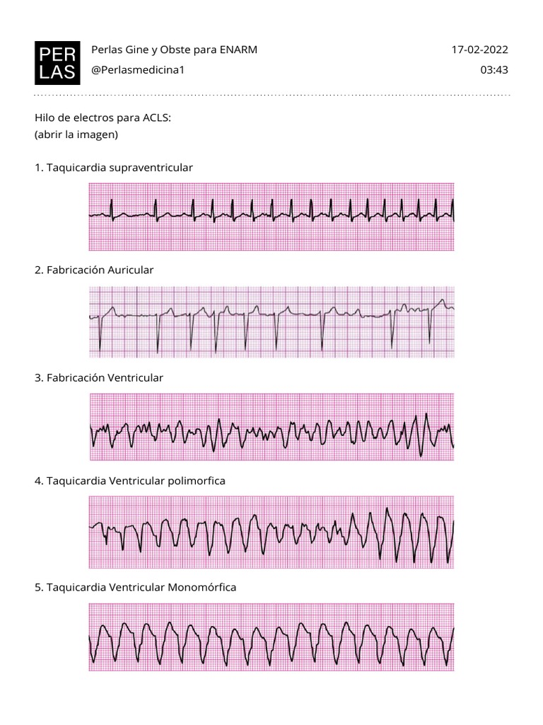 Respuestas ACLS ECG 2022 - iMPRIMIBLE | PDF