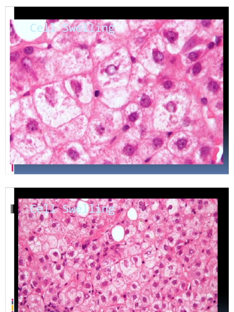 Degeneration and Necrosis | PDF
