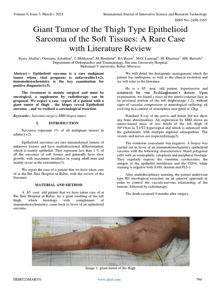 Giant Tumor of The Thigh Type Epithelioid Sarcoma of The Soft Tissues A ...