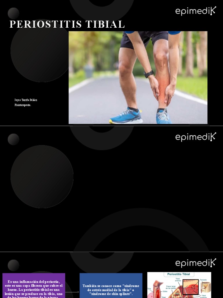 Periostitis Tibial | PDF | Inflamación | Macrófago