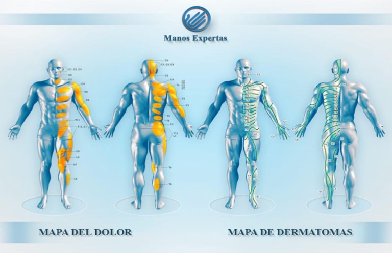 Mapa Del Dolor y Mapa de Dermatomas PDF | PDF