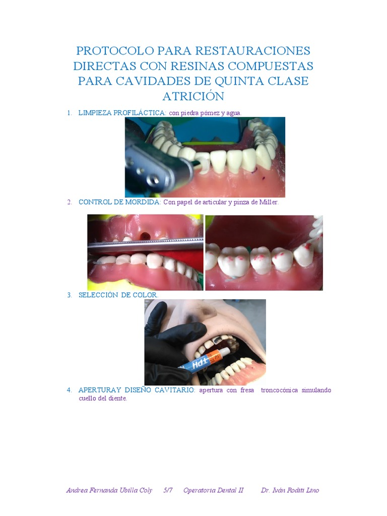 Protocolo para Restauraciones Directas Con Resinas Compuestas para Cavidades de Quinta Clase ...