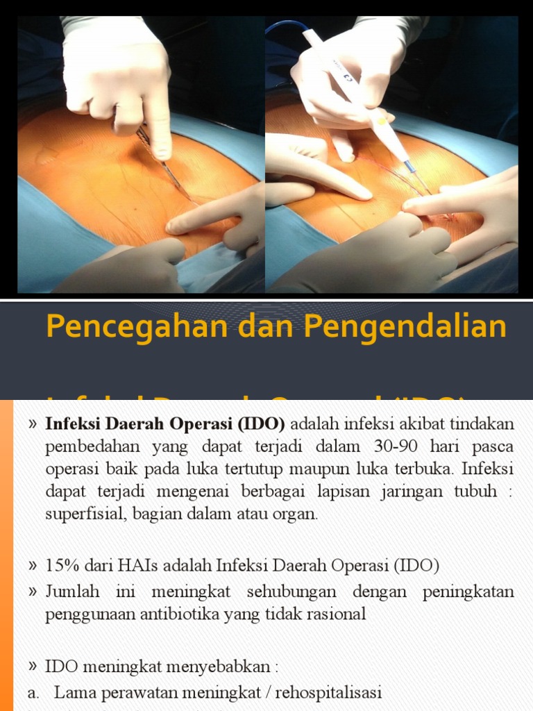 Ppi Ido | PDF