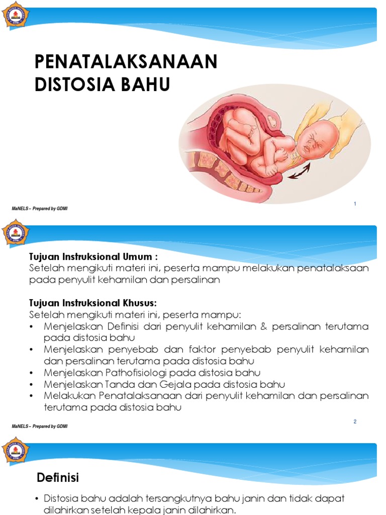 Slide 8 Distosia Bahu | PDF | Kesehatan Holistik | Sains & Matematika