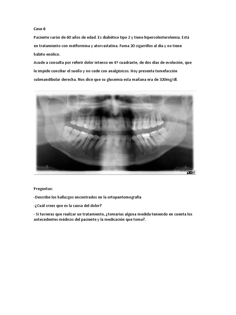 Caso 6 - 2022-23 | PDF