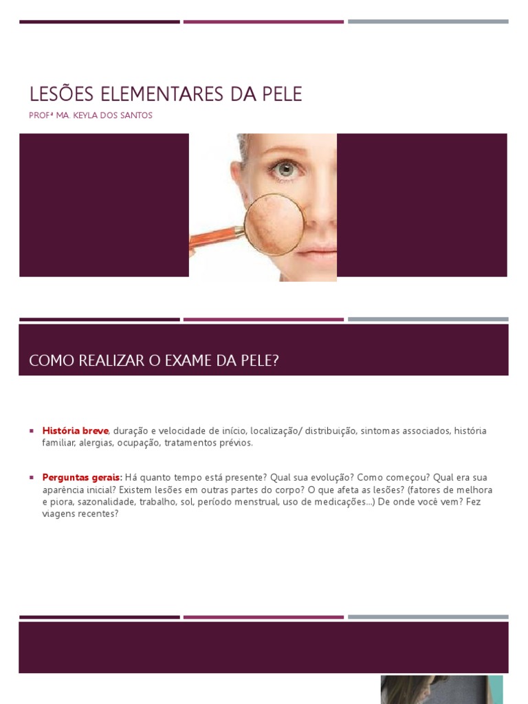 Aula 5 - Lesões Elementares Da Pele | PDF | Pele | Especialidades médicas