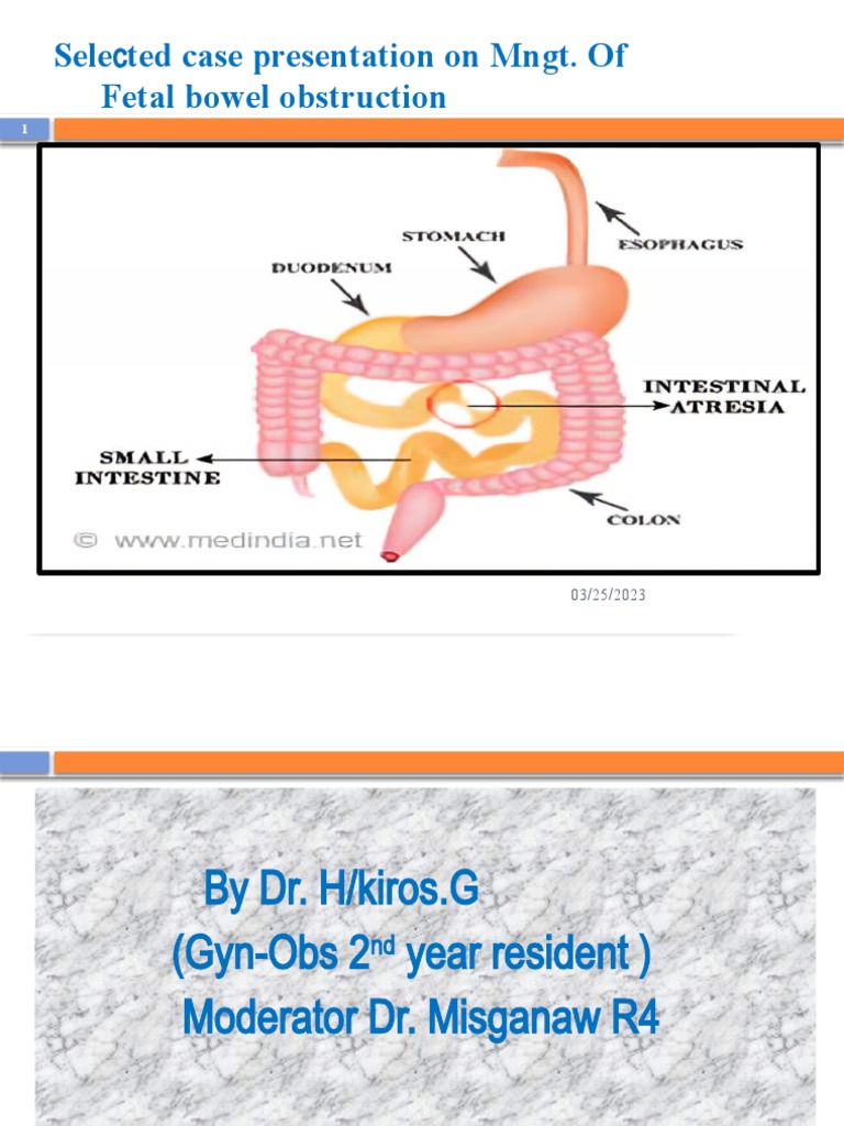Fetal Bowel Obstruction | PDF | Medical Specialties | Clinical Medicine