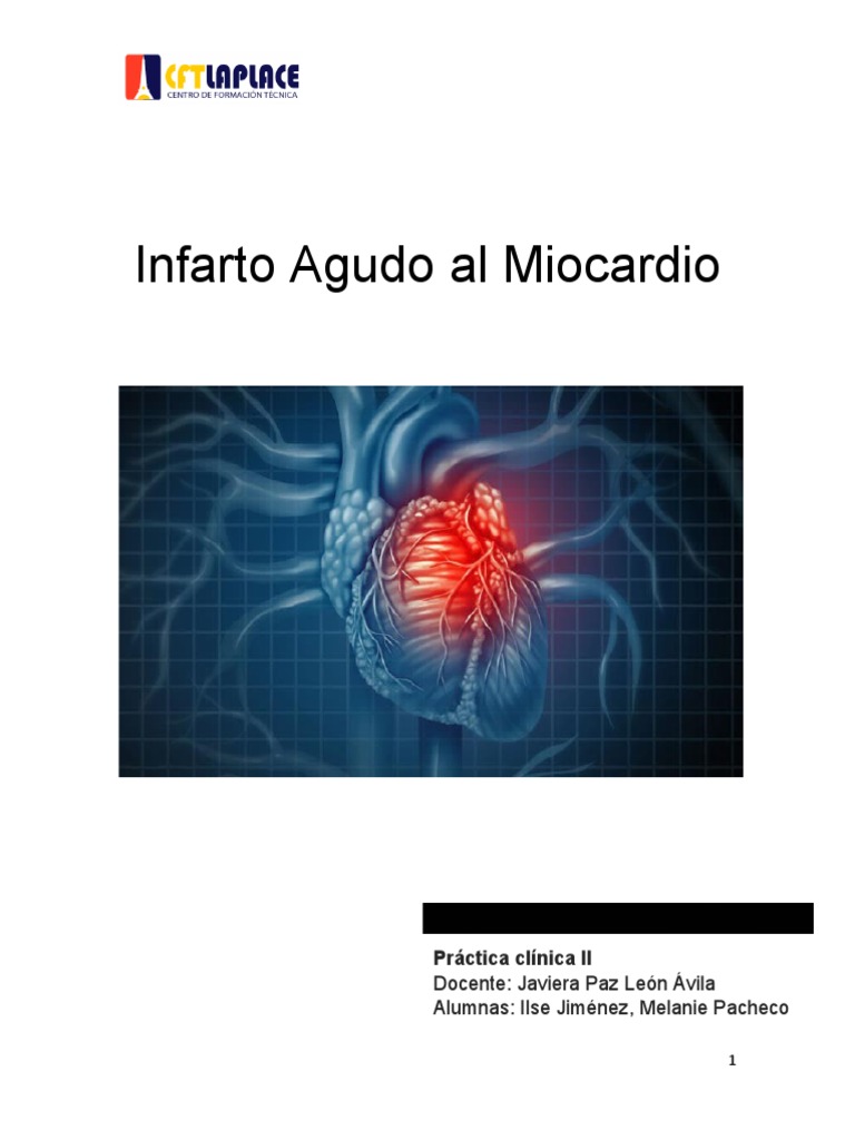 Infarto Agudo Al Miocardio: Práctica Clínica II | PDF | Infarto de miocardio | Medicina CLINICA