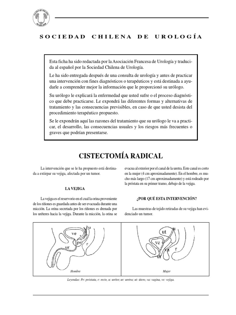 Sociedad Chilena de Urología explica cistectomía radical | PDF | Vejiga ...