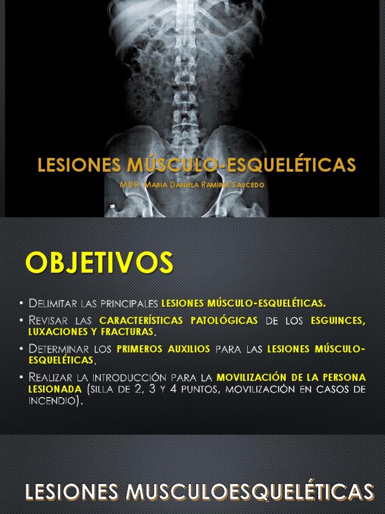 Lesiones Músculo Esqueléticas PDF | PDF | Hueso | Lesión