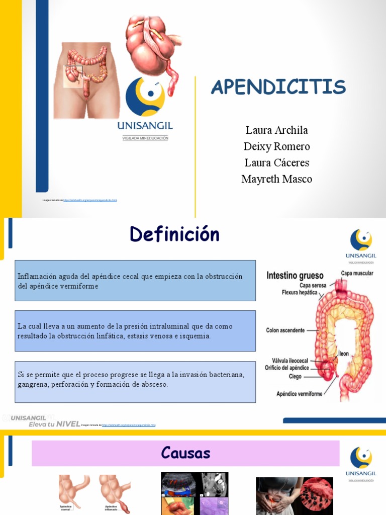 APENDICITIS | PDF | Ciencias de la Salud | Medicina CLINICA