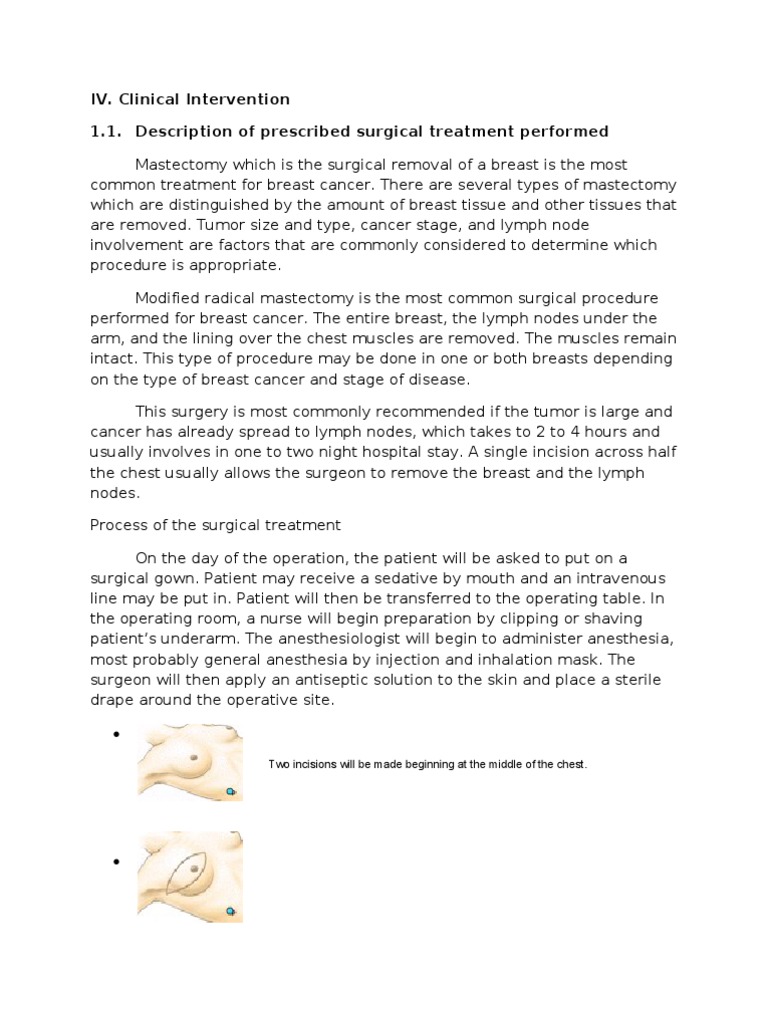 Modified Radical Mastectomy Overview | PDF | Mastectomy | Surgery