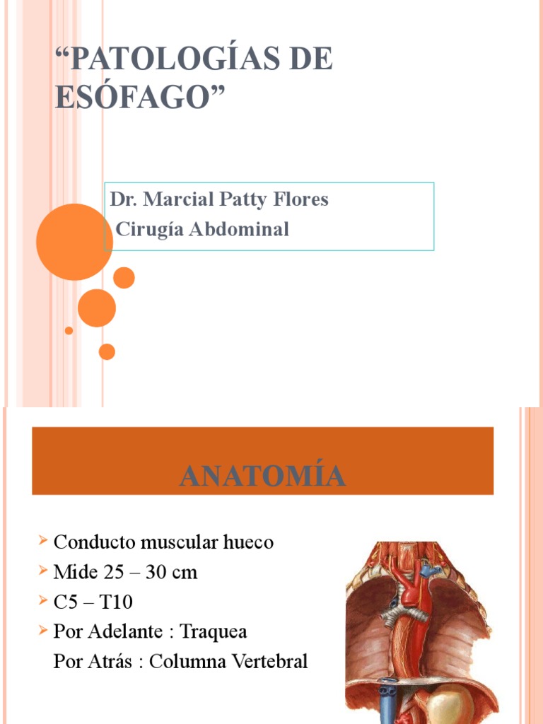 PATOLOGIA DE ESOFAGO | PDF | La enfermedad por reflujo gastroesofágico ...