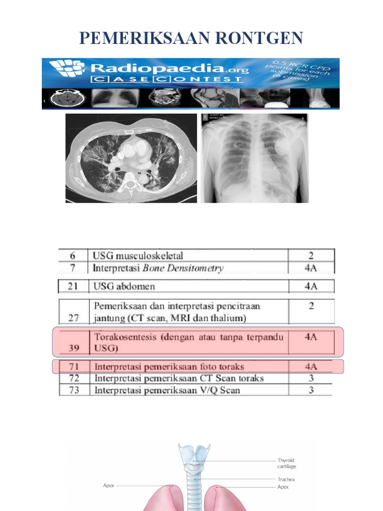 TINJAUAN RONTGEN THORAX DAN INTERPRETASINYA | PDF