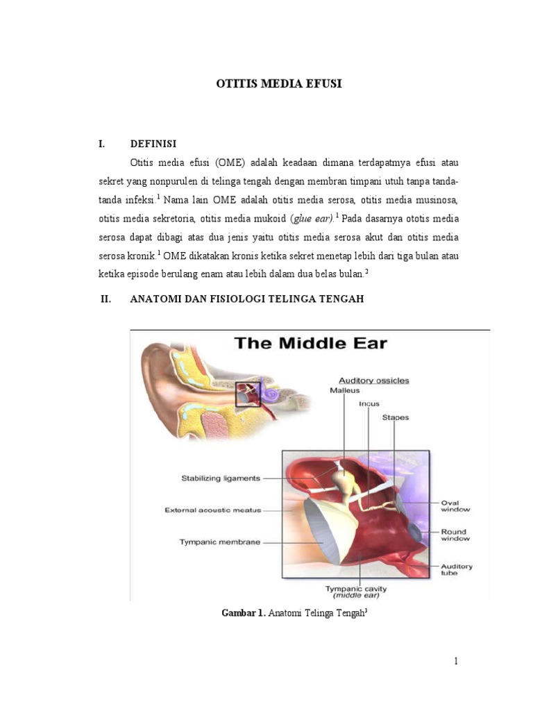 Otitis Media Efusi Fix | PDF