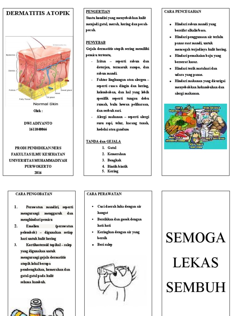 Patient Information Leaflet Hand Dermatitis – GKAALN