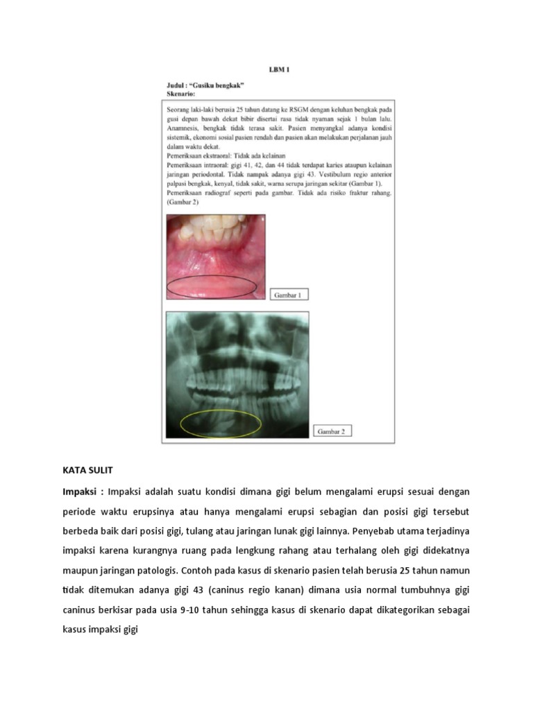 Skenario LBM 1 | PDF