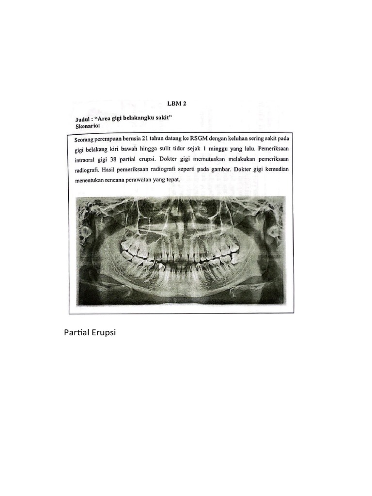 Skenario LBM 2 | PDF