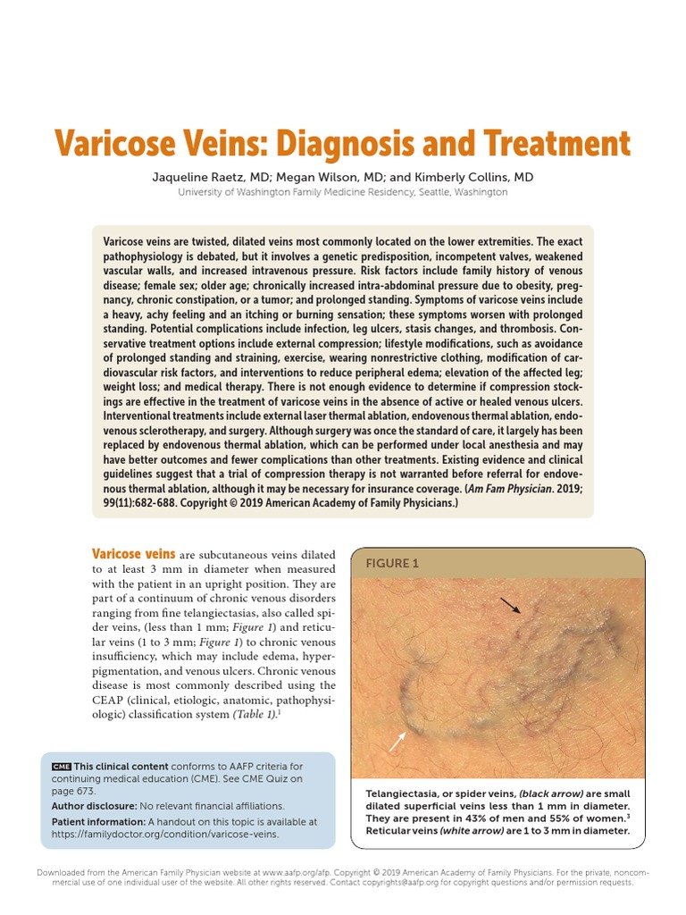 Varicose Veins Diagnosis and Treatment | PDF | Varicose Veins | Vein