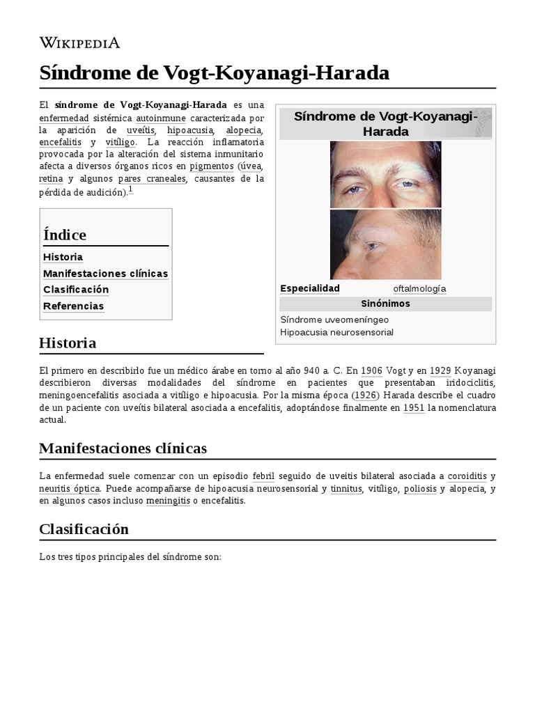 Síndrome_de_Vogt-Koyanagi-Harada | PDF