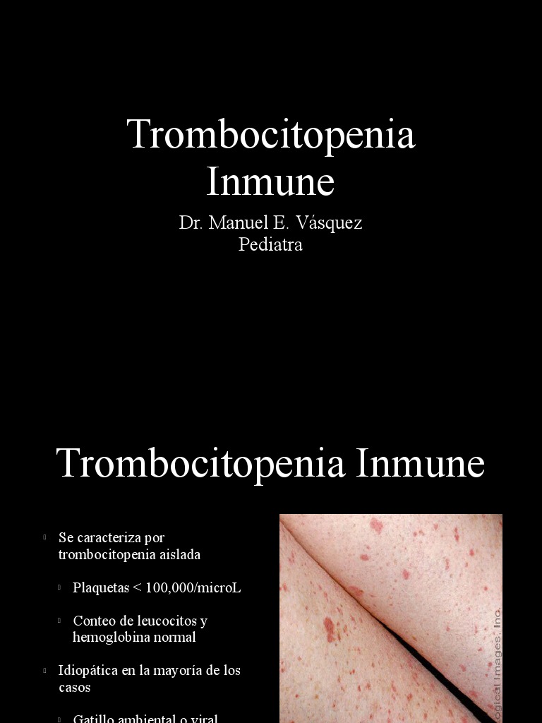 Trombocitopenia Inmune: Dr. Manuel E. Vásquez Pediatra | PDF | Ciencias ...