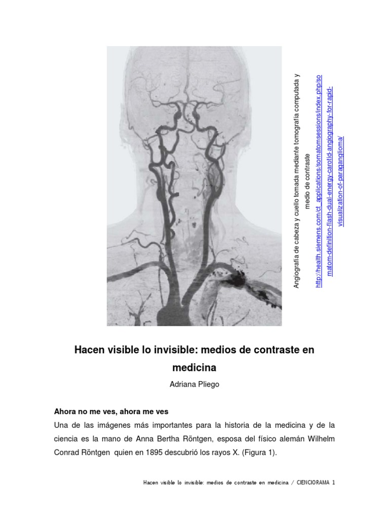 Angiografía de cabeza y cuello mediante tomografía computarizada con ...
