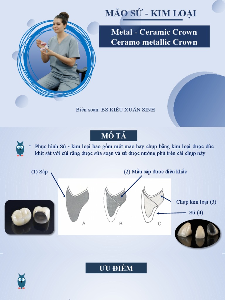 Mão S - Kim Lo I: Metal - Ceramic Crown Ceramo Metallic Crown | PDF