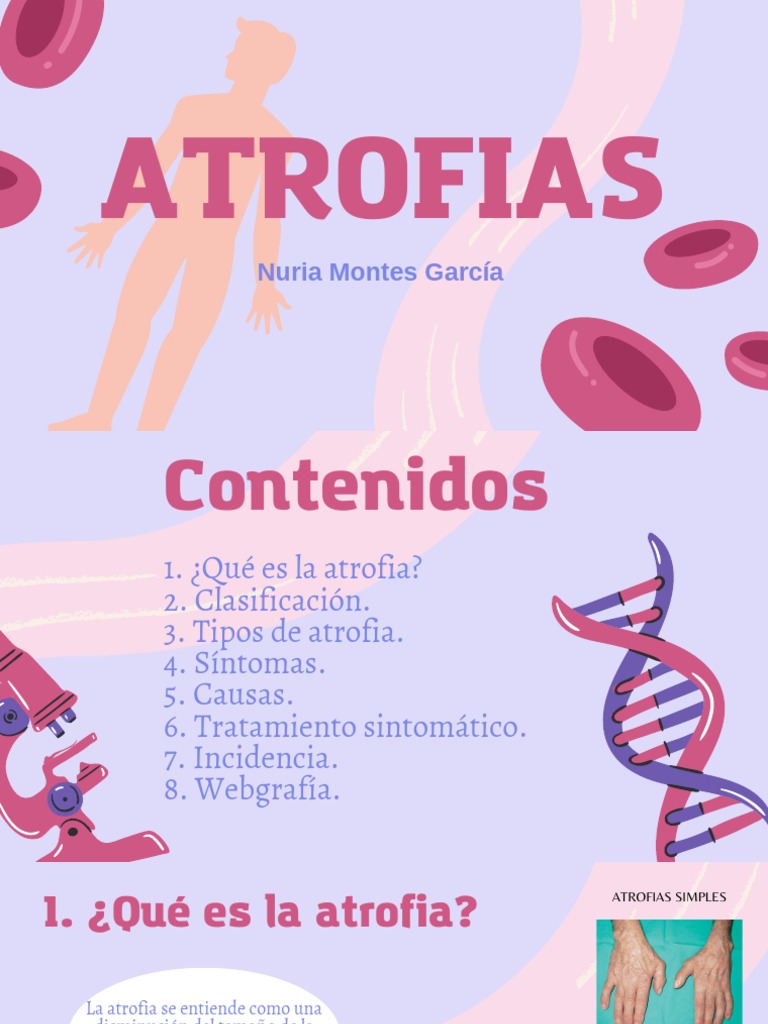 ATROFIAS | PDF | Atrofia | Medicina CLINICA