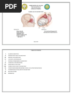 NCP - Impaired Urinary Elimination | PDF | Urinary Incontinence ...